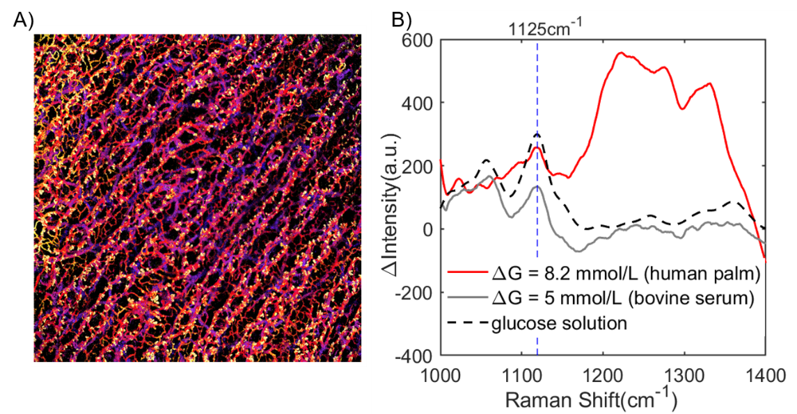 News - Direct Observation of Glucose Raman Peaks in Transcutaneous Non ...